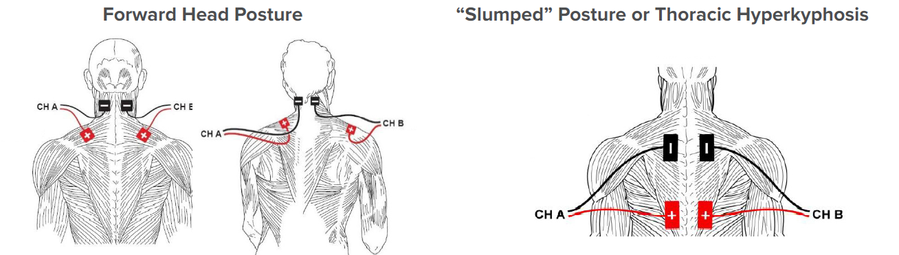 Optimizing Head, Neck and Trunk Positioning to Impact Swallow ...