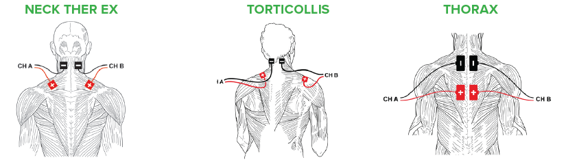 Diaphragmatic Breathing Exercise and Patterned Electrical Neuromuscular ...