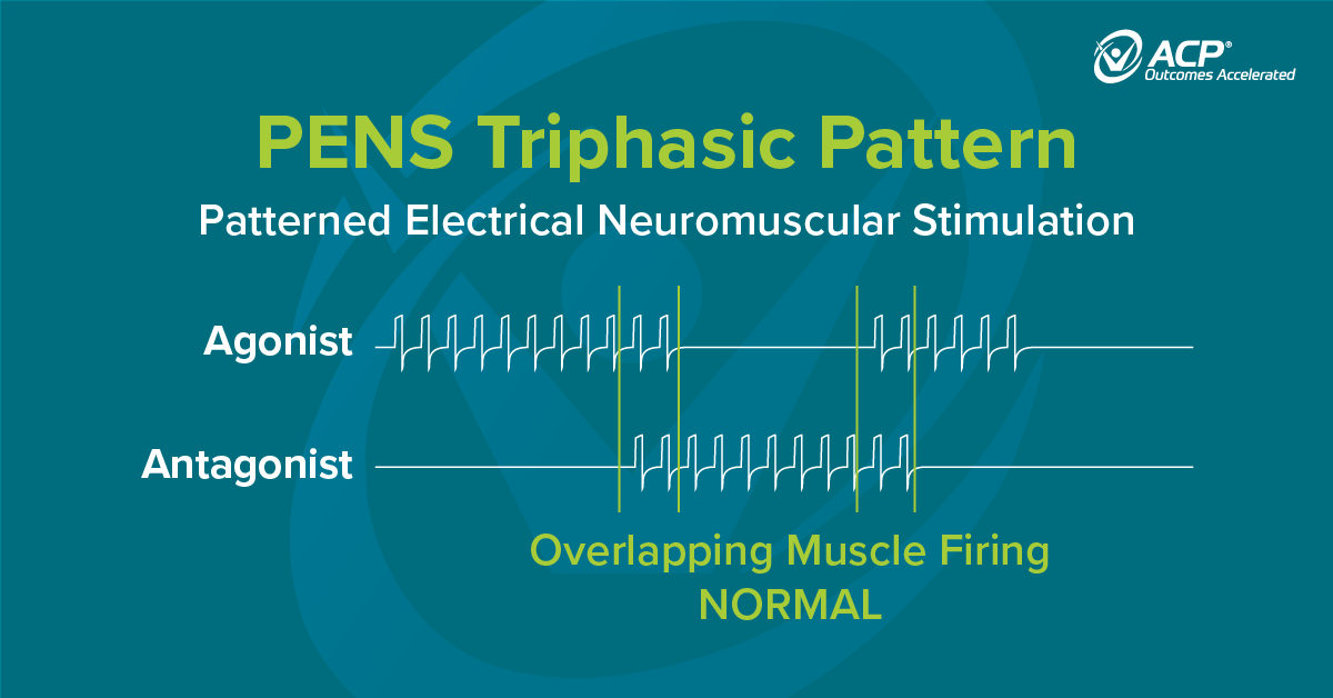New evidence shows Patterned Electrical Neuromuscular Stimulation (PENS ...