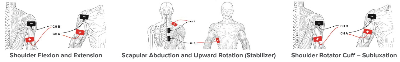 Shoulder Rehabilitation Using Isometrics and Biophysical Agents